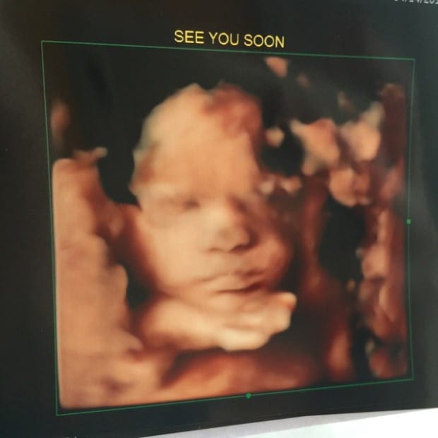 My 28 week HD Ultrasound - Modern Day Moms